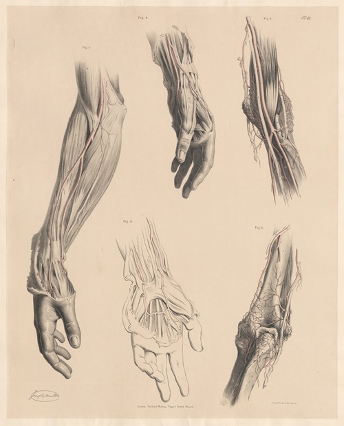 The Popliteal artery, and its peculiarities - Artvee