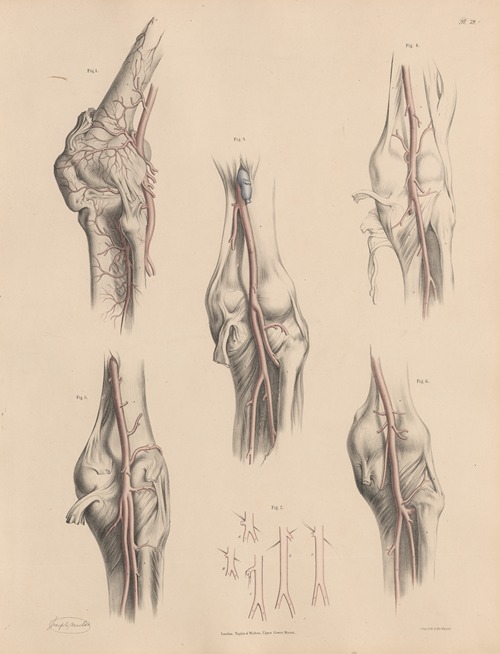 The Popliteal artery, and its peculiarities - Artvee