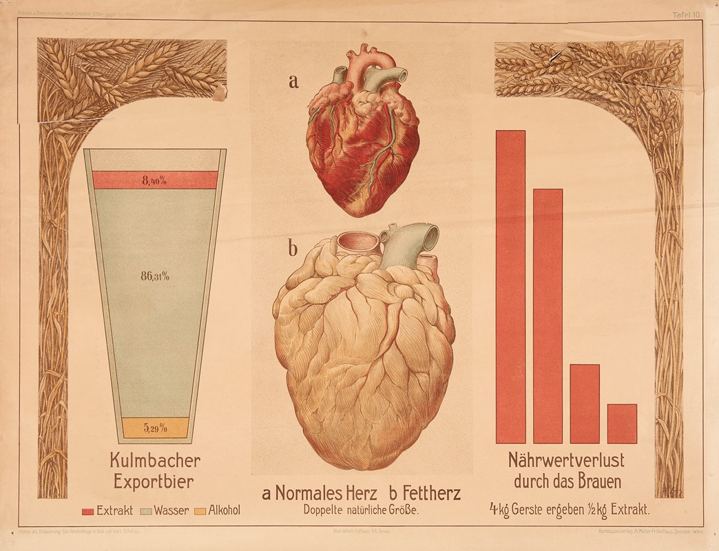 Beer, normal heart and fatty heart - Artvee