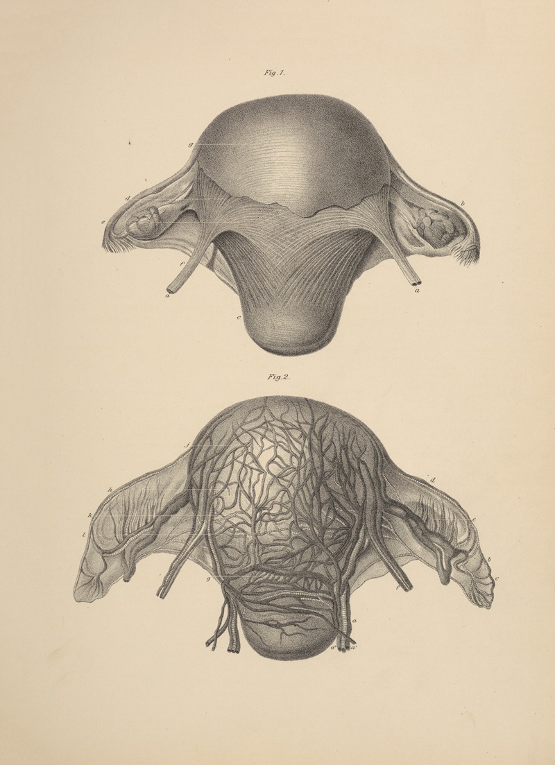 Uterus of a Woman who Died two days after Delivery, intended to exhibit ...